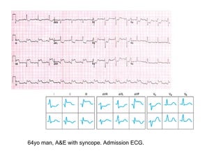 Osce ecg | PPT