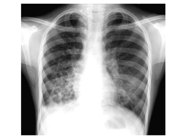 Osce radiology | PPT