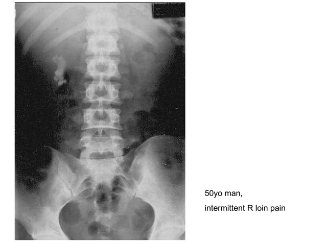 Osce radiology | PPT
