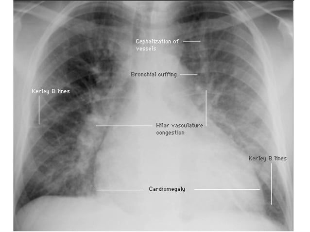 Osce radiology | PPT