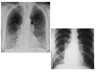 Osce radiology | PPT