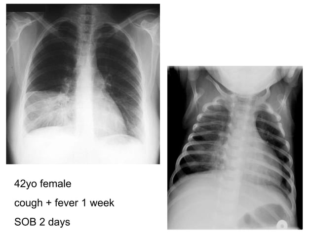 Osce radiology | PPT