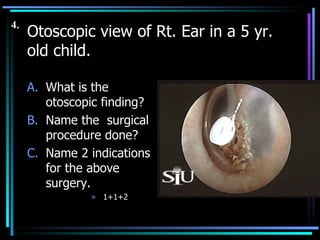 Osce 03ans | PPT