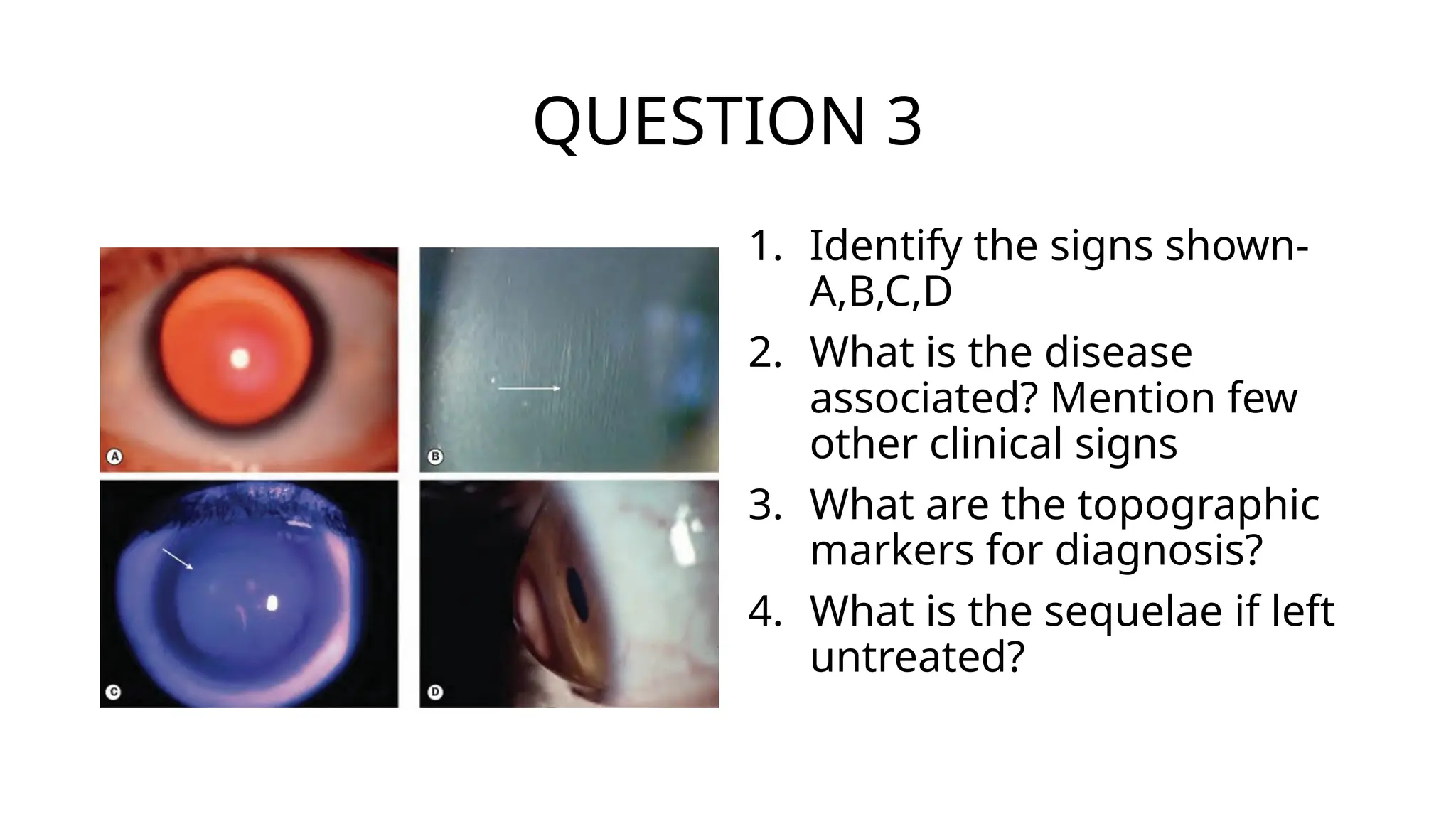 DNB Practical Opthalmology OSCE Questions 2 | PPTX