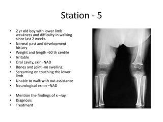 OSCE APRIL 2022-PART-3 -PAED.pptx
