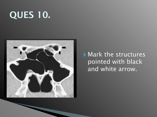 DNB osce examination practical part two ENT | PPT