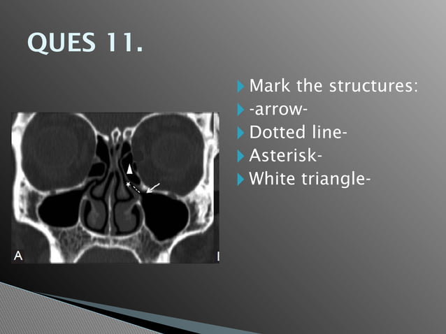 DNB osce examination practical part two ENT | PPT