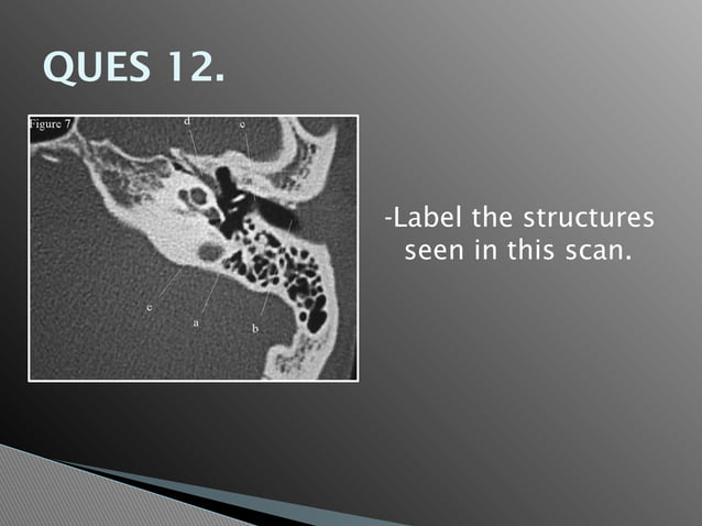 DNB osce examination practical part two ENT | PPT