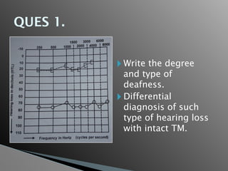 DNB osce examination practical part two ENT | PPT