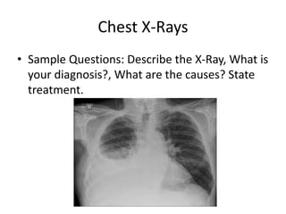 OSCE Stations For MBBS | PPTX