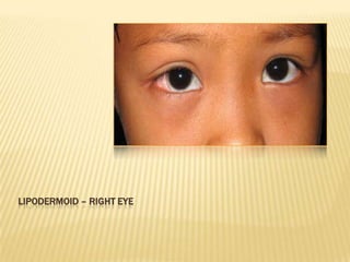 Osce for mbbs students 1 | PPT