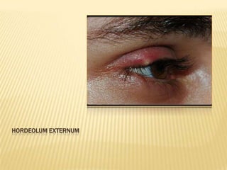 Osce for mbbs students 1 | PPTX