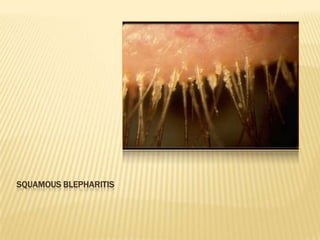 Osce for mbbs students 1 | PPT