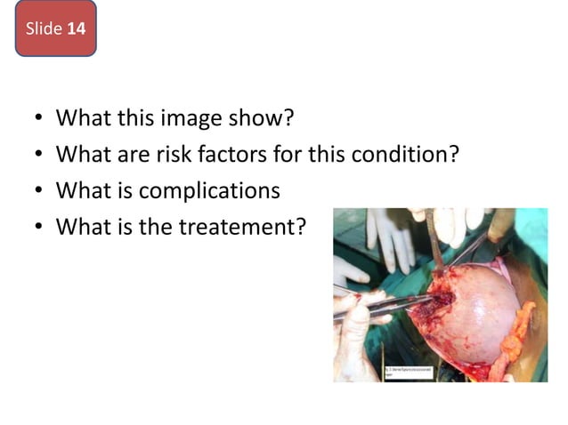 Osce in obstetrics&gynecology for undergraduate | PPTX