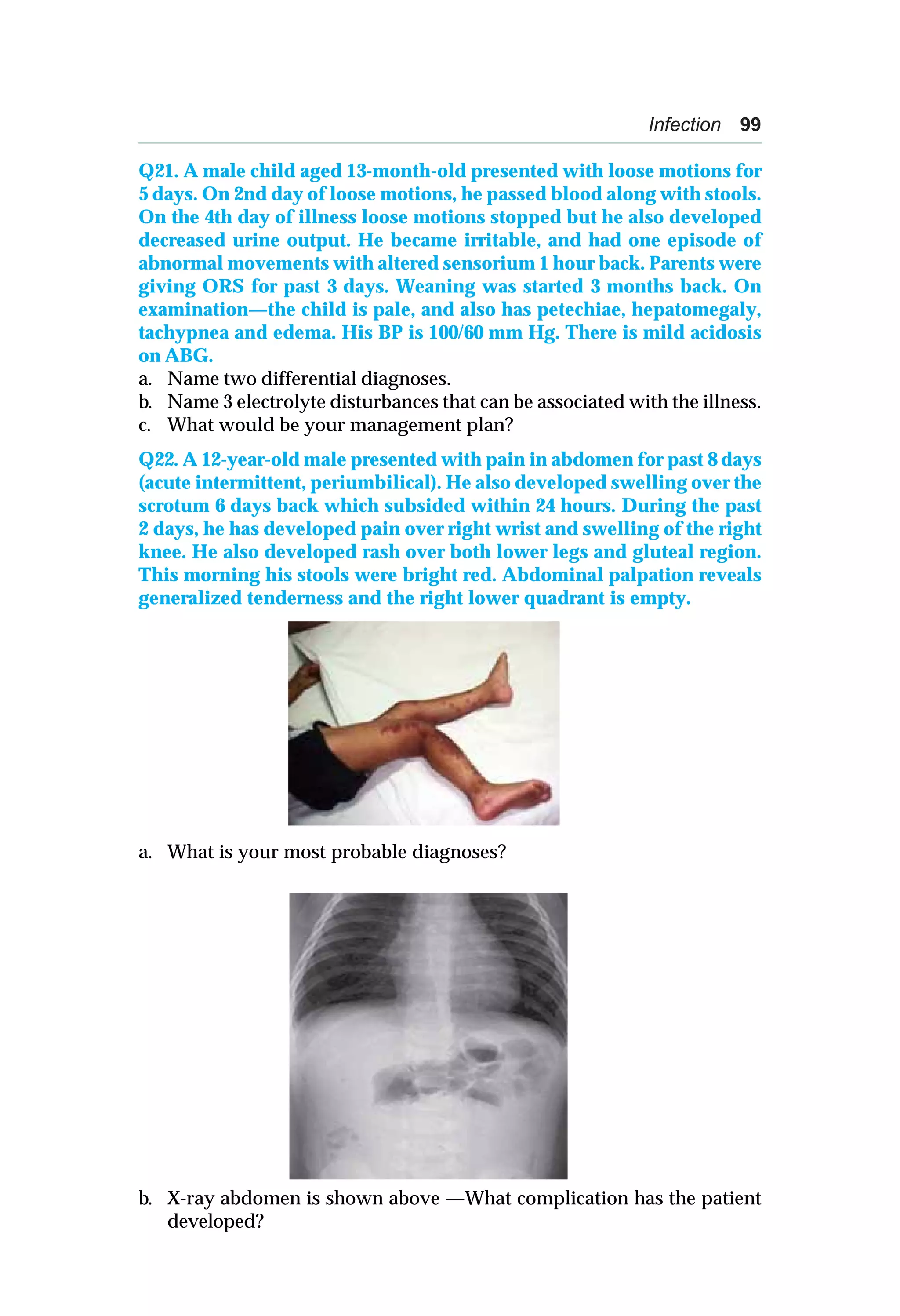 Osce in pediatrics | PDF