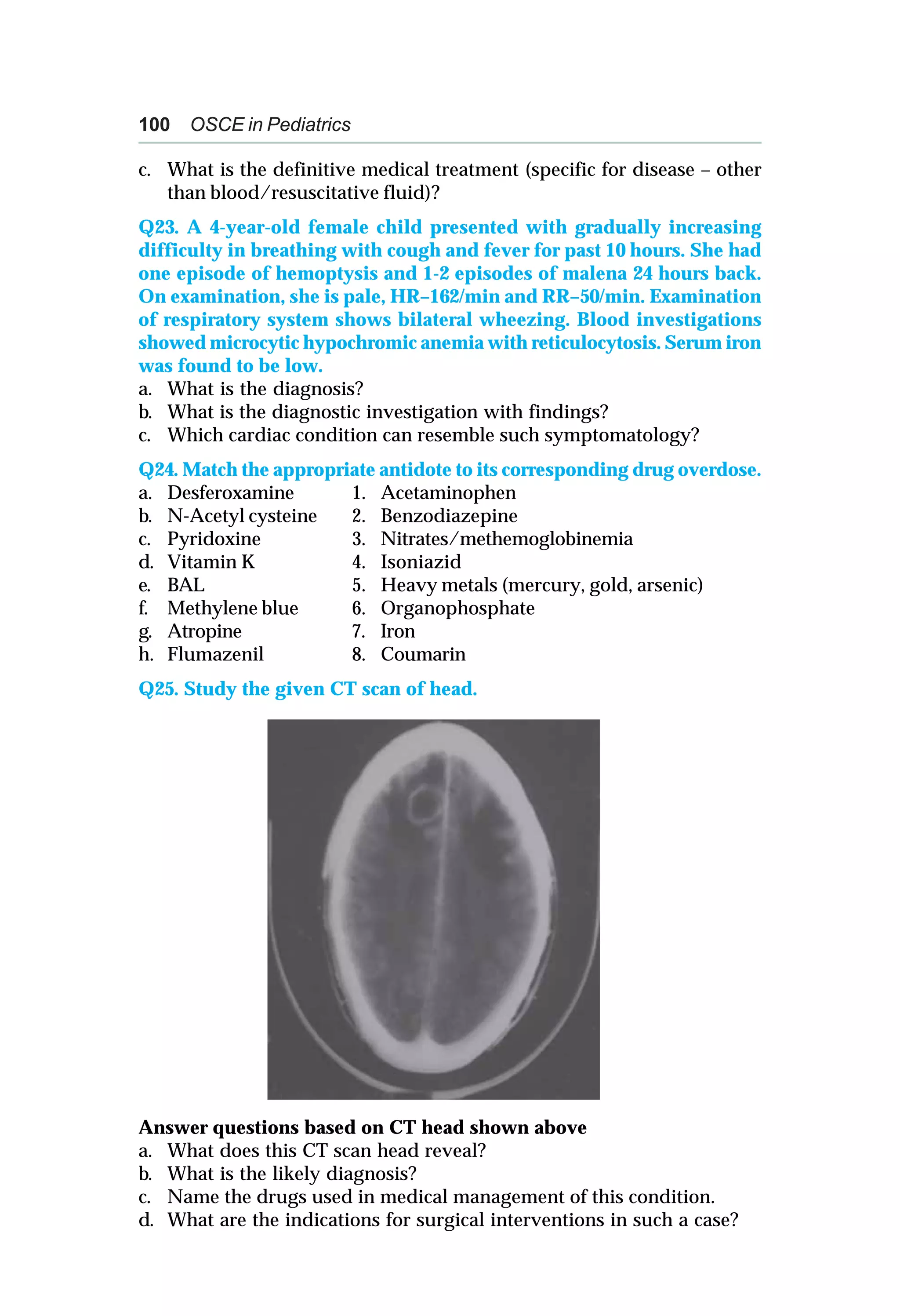 Osce in pediatrics | PDF