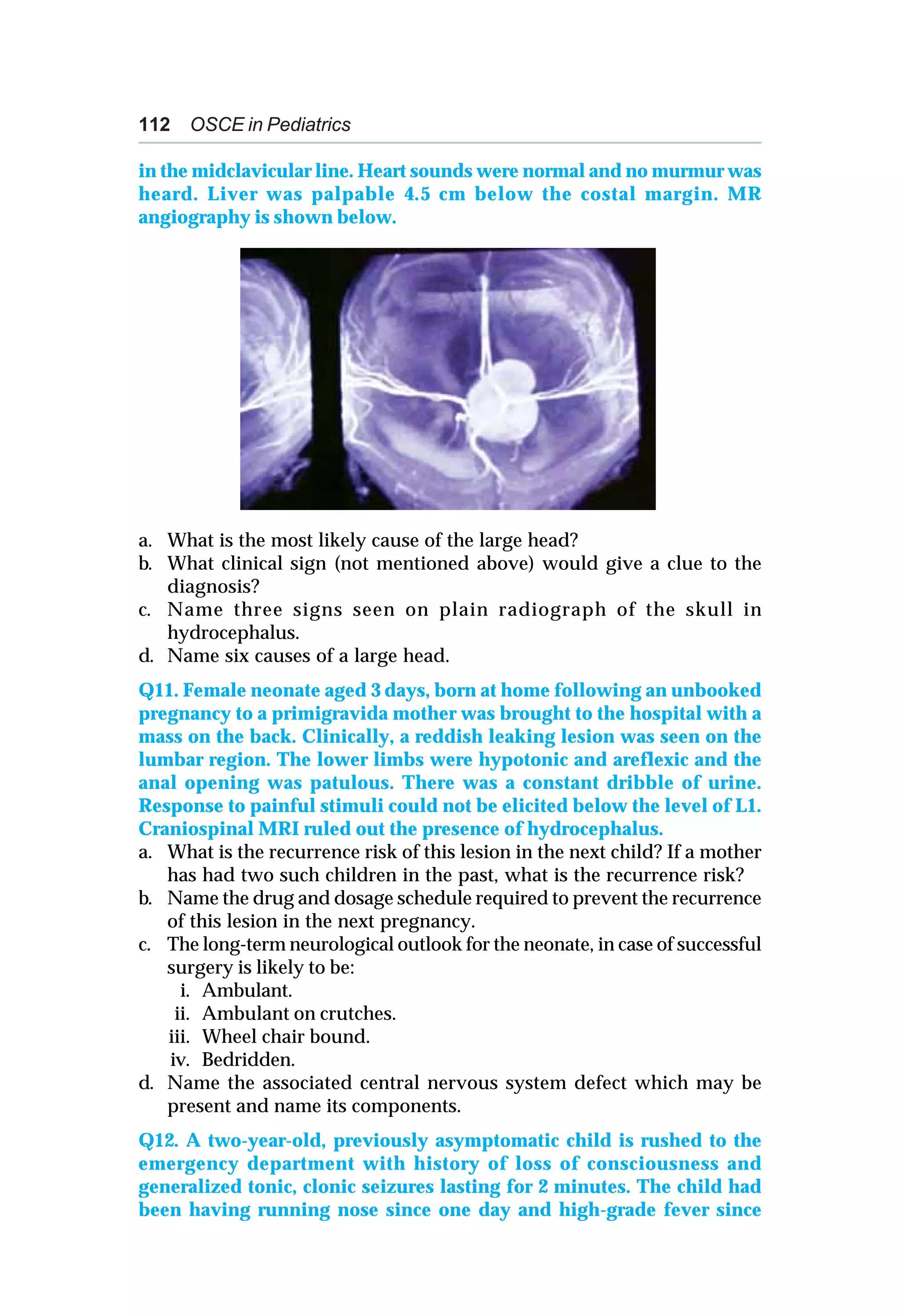 Osce in pediatrics | PDF