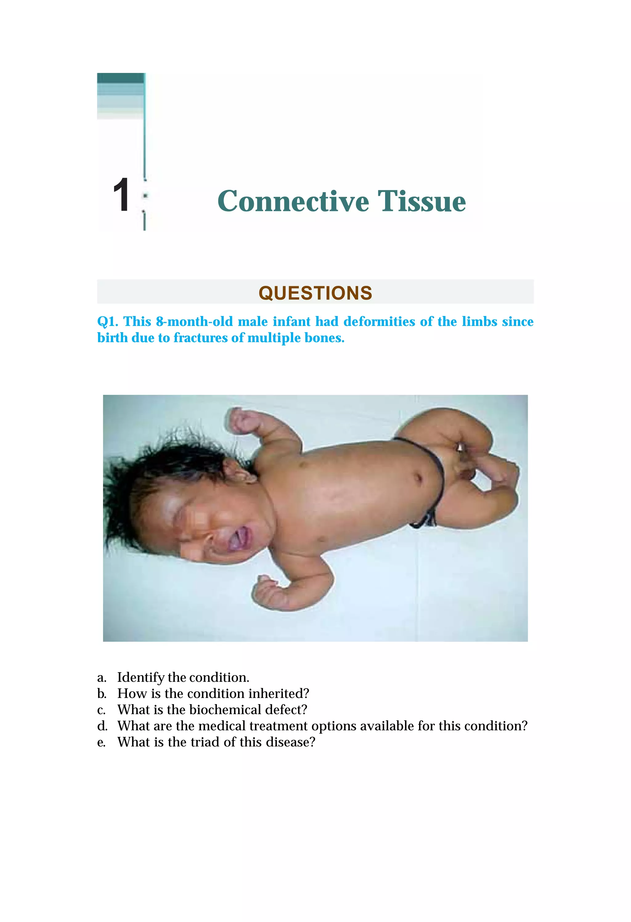Osce in pediatrics | PDF