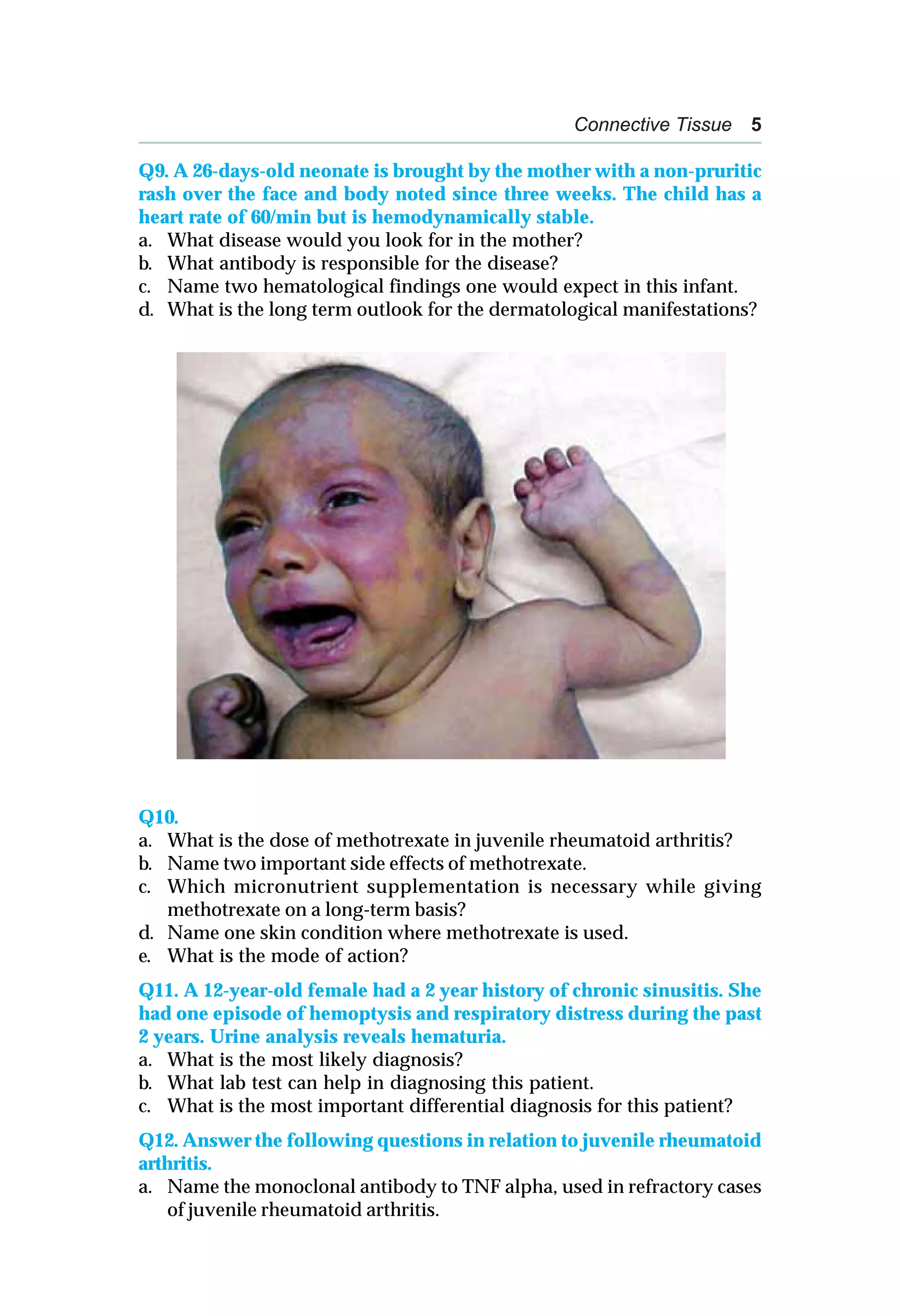 Osce in pediatrics | PDF
