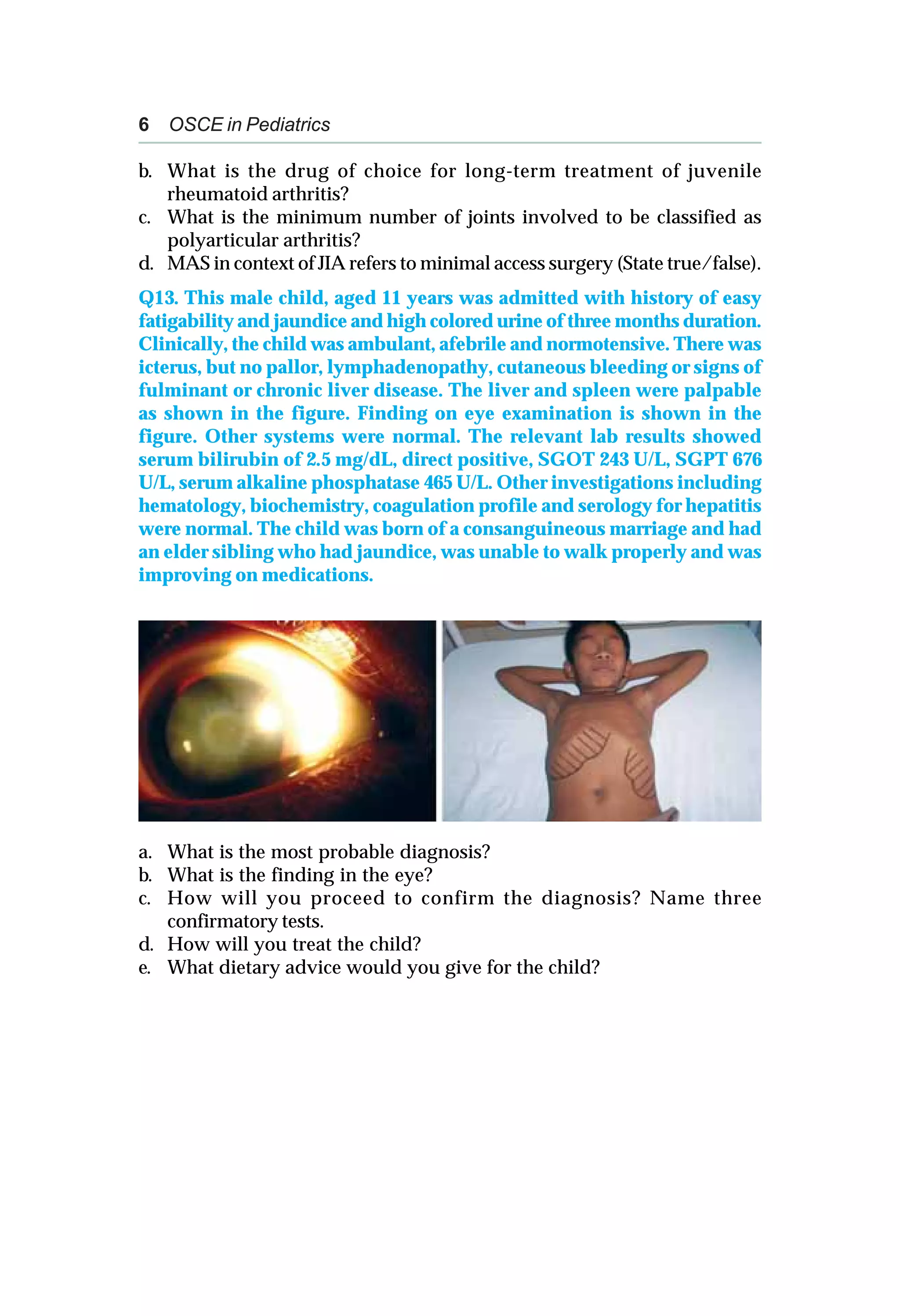 Osce in pediatrics | PDF