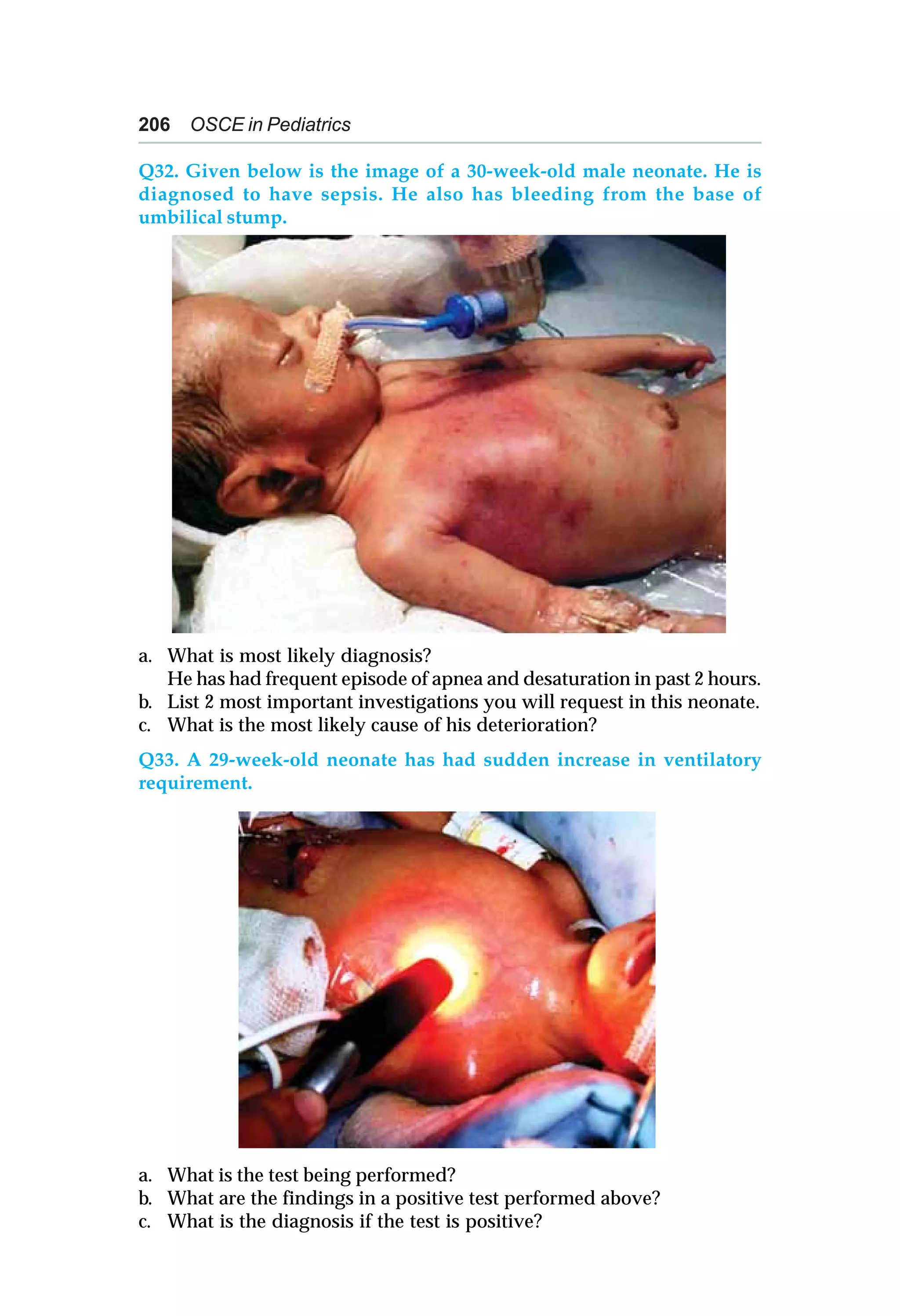 Osce in pediatrics | PDF