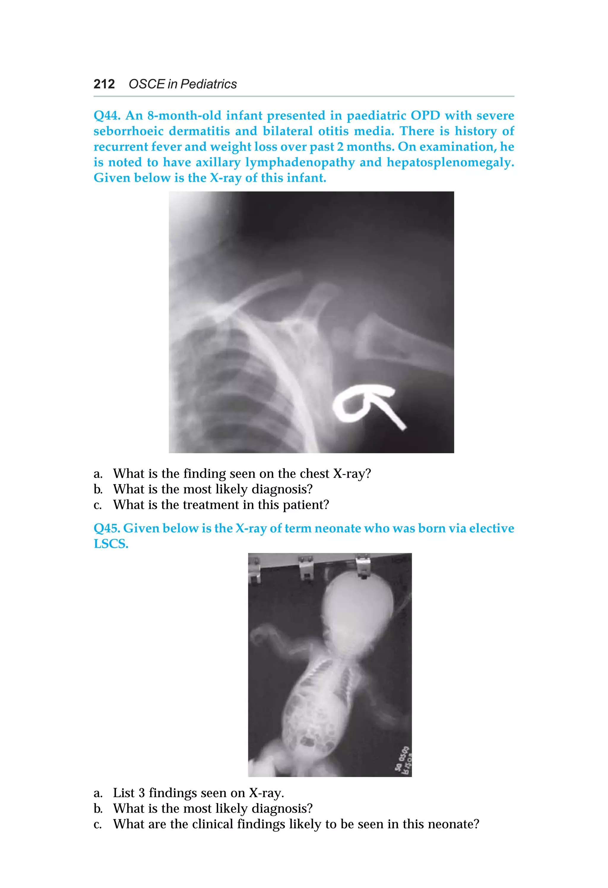 Osce in pediatrics | PDF