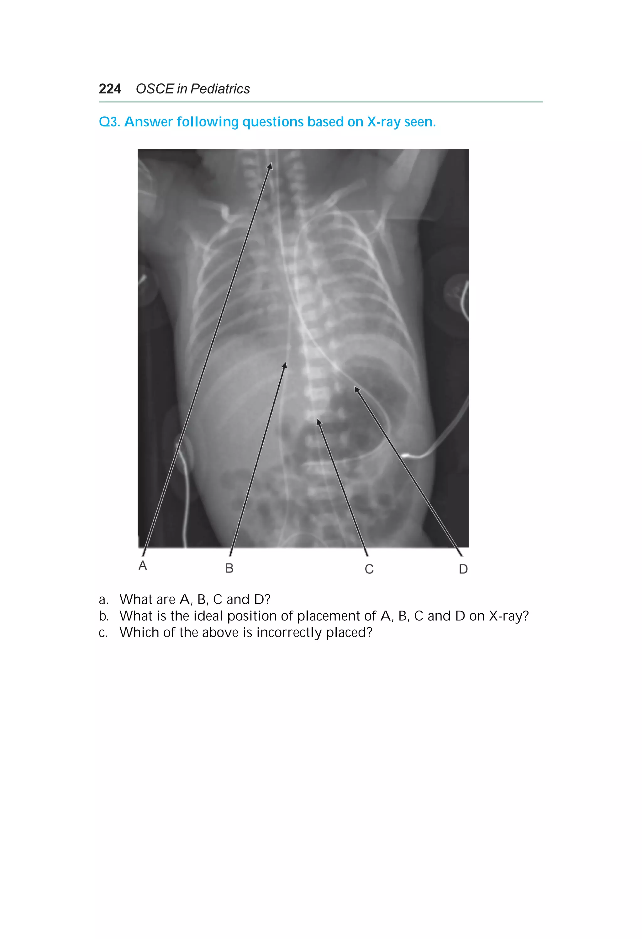 Osce in pediatrics | PDF