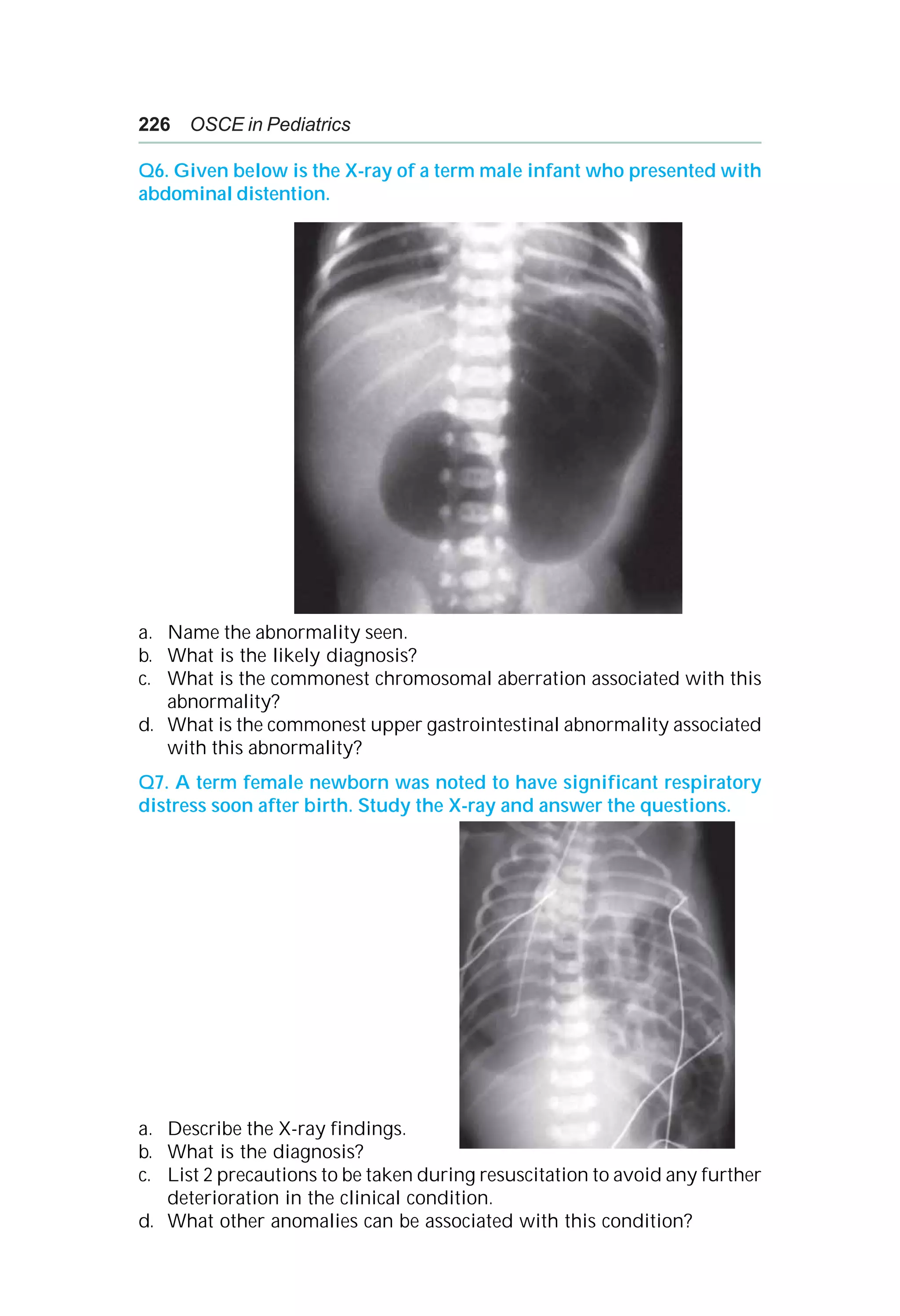 Osce in pediatrics | PDF
