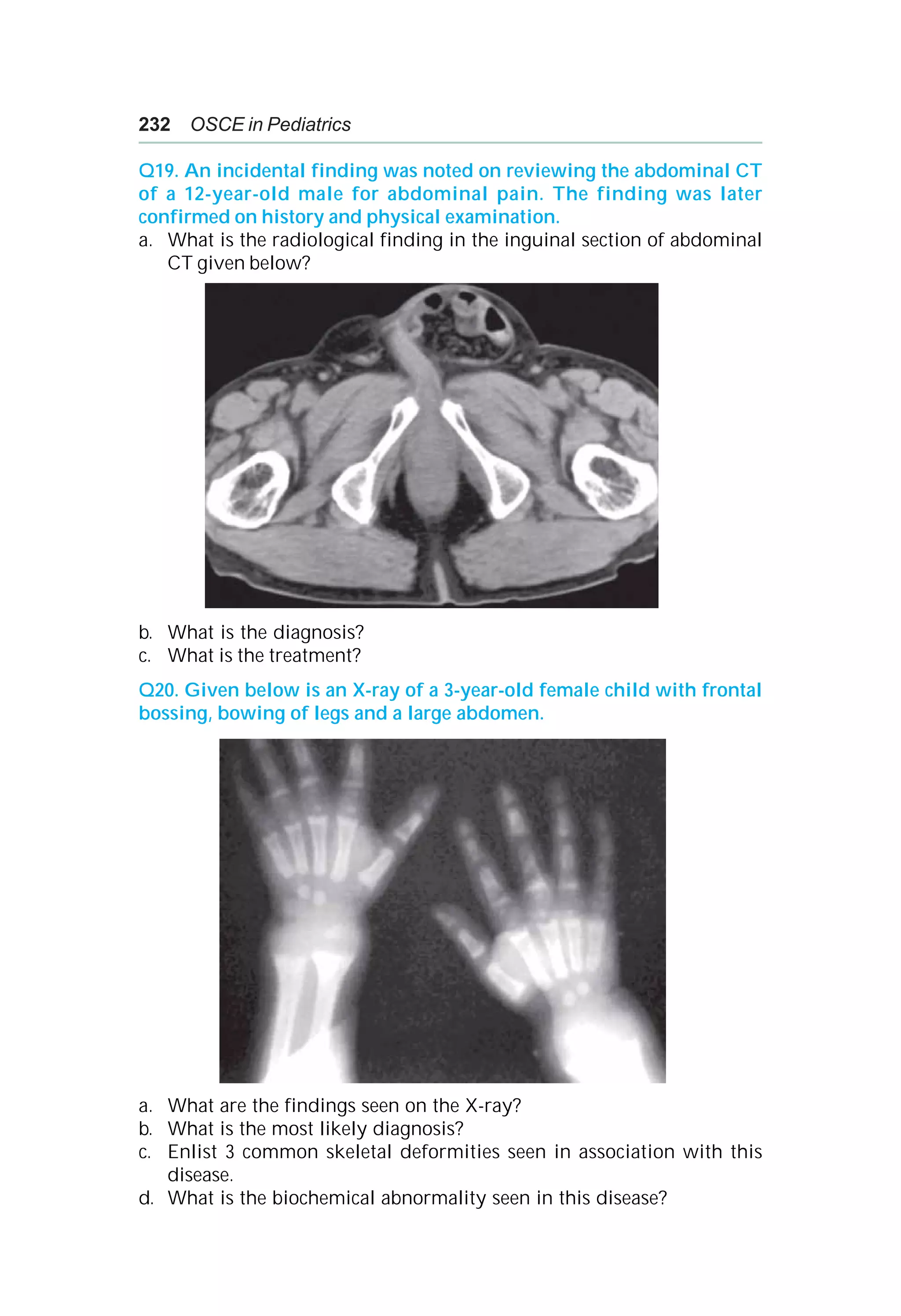Osce in pediatrics | PDF