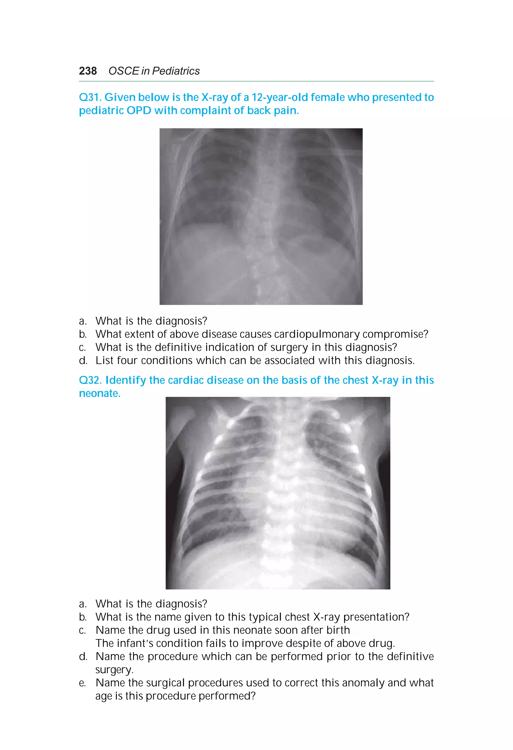 Osce in pediatrics | PDF