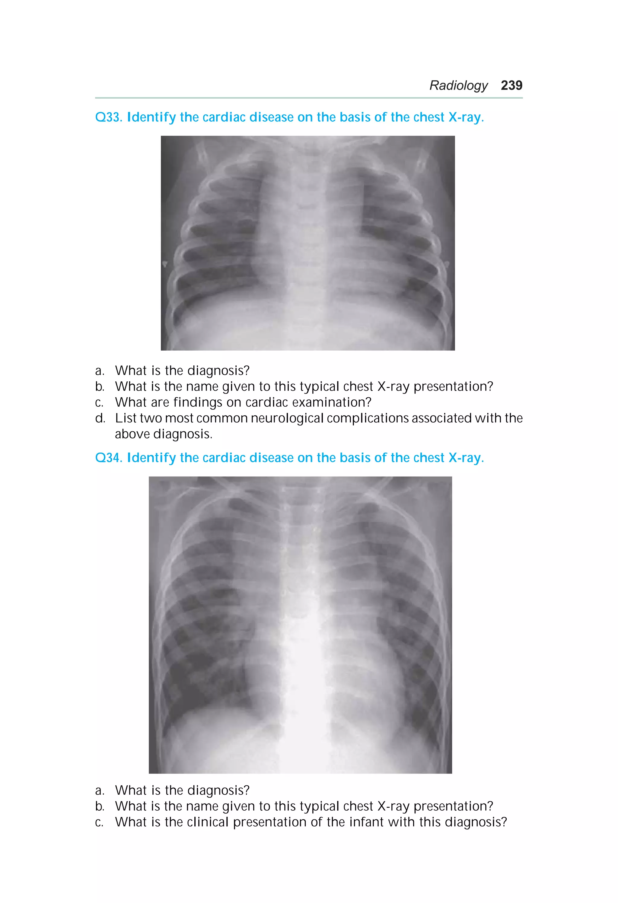 Osce in pediatrics | PDF