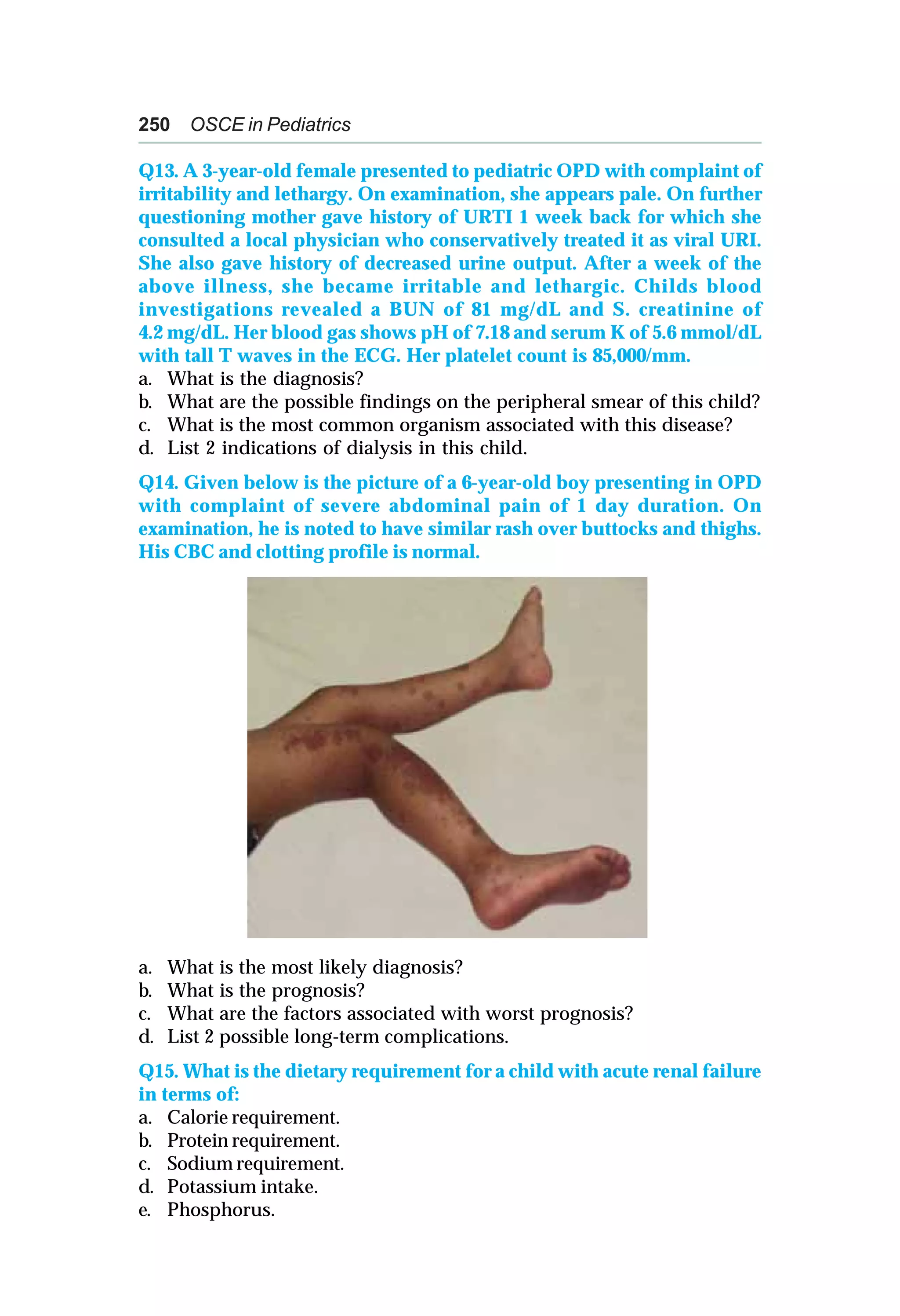 Osce in pediatrics | PDF