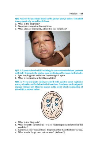 Osce in pediatrics | PDF