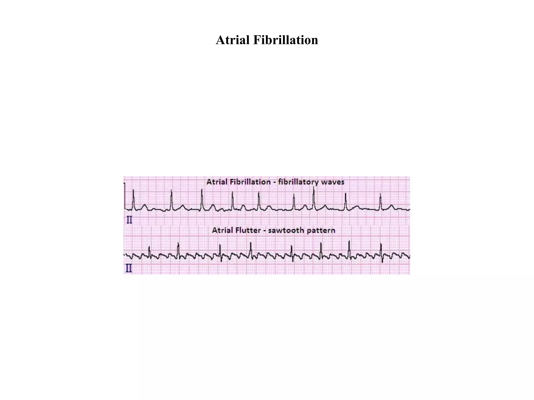 OSCE Instruments and Ecg Medicine .pptx