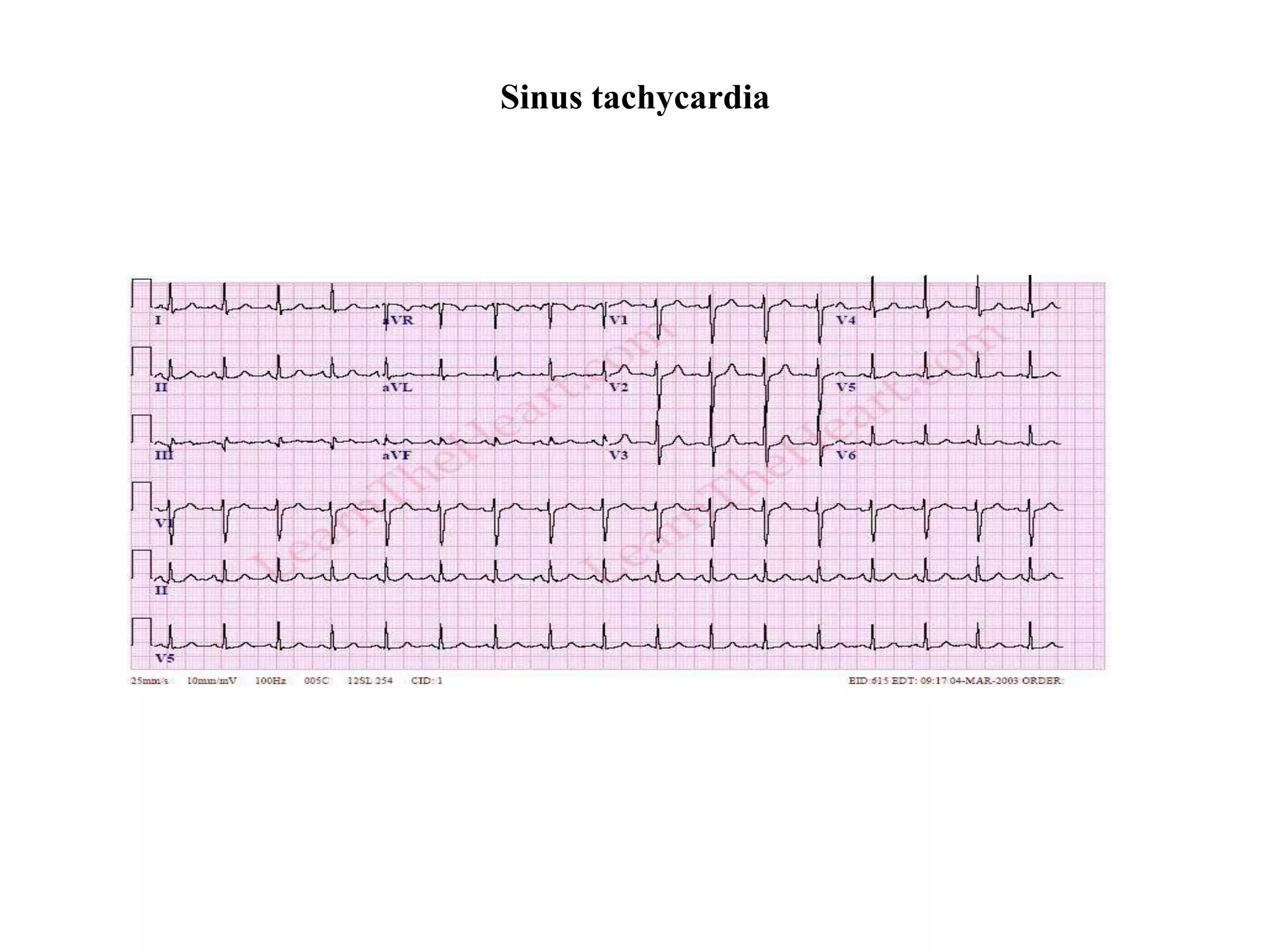 OSCE Instruments and Ecg Medicine .pptx