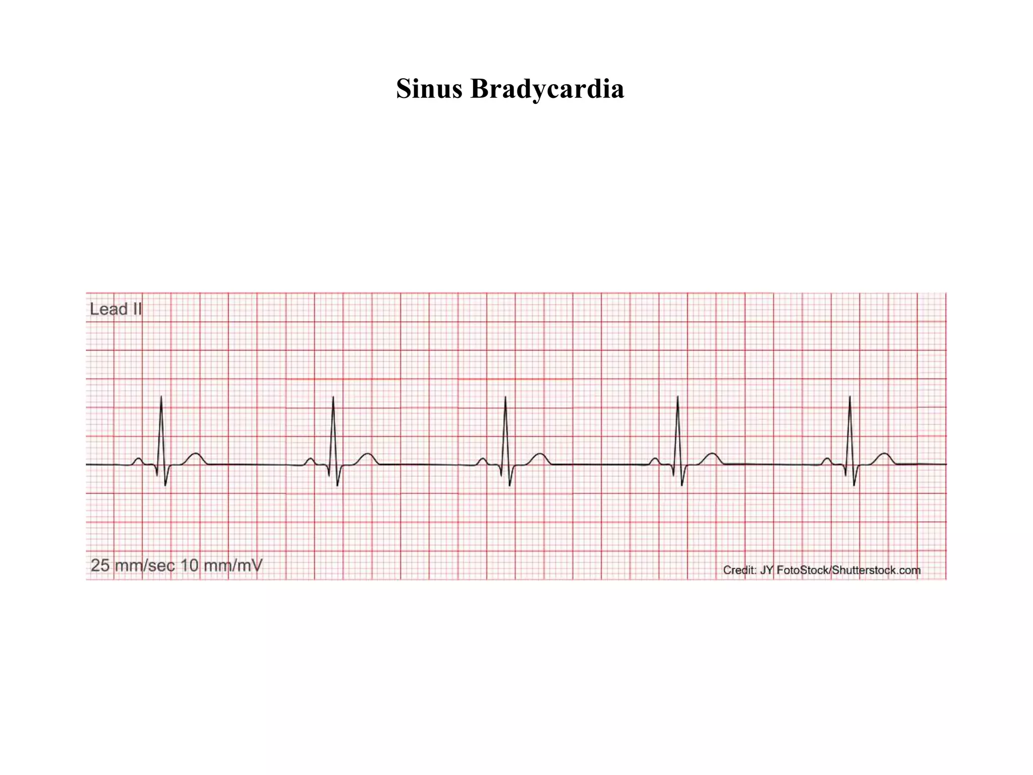 OSCE Instruments and Ecg Medicine .pptx