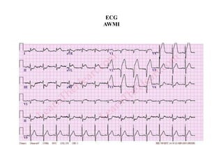 OSCE Instruments and Ecg Medicine .pptx