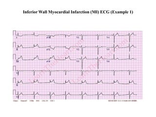 OSCE Instruments and Ecg Medicine .pptx