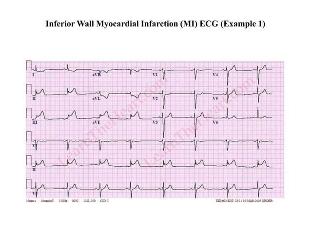OSCE Instruments and Ecg Medicine .pptx