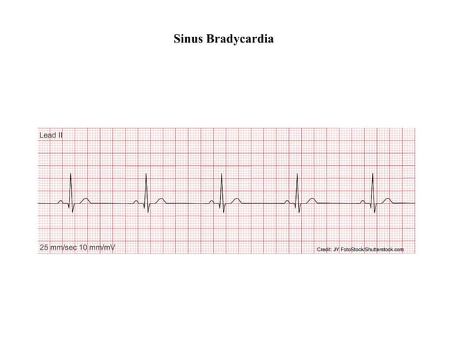 OSCE Instruments and Ecg Medicine .pptx