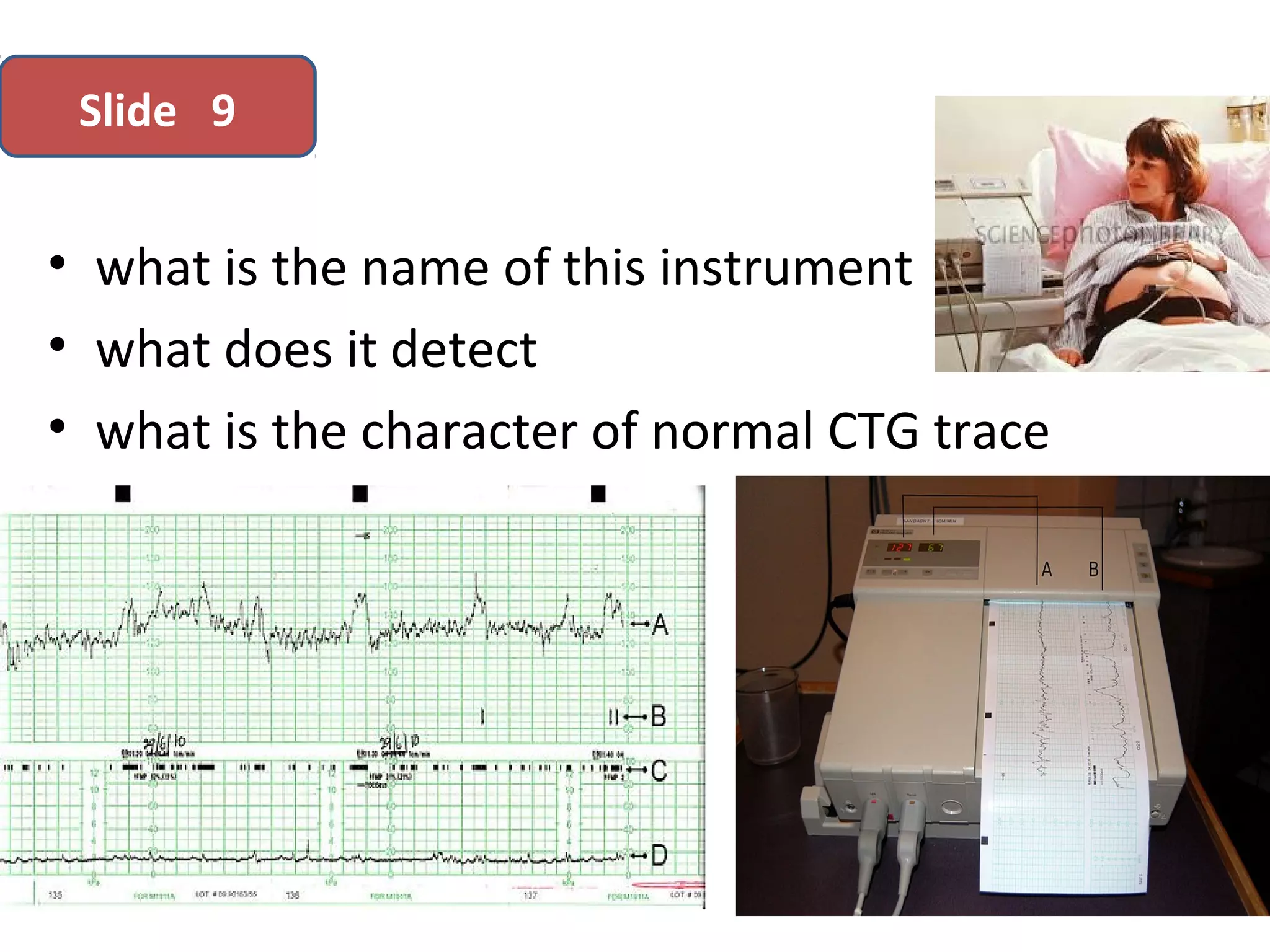 Osce obstetrics for undergraduate | PPT