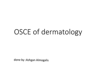 OSCE of dermatology اختبار في مواضيع الجلدية | PDF