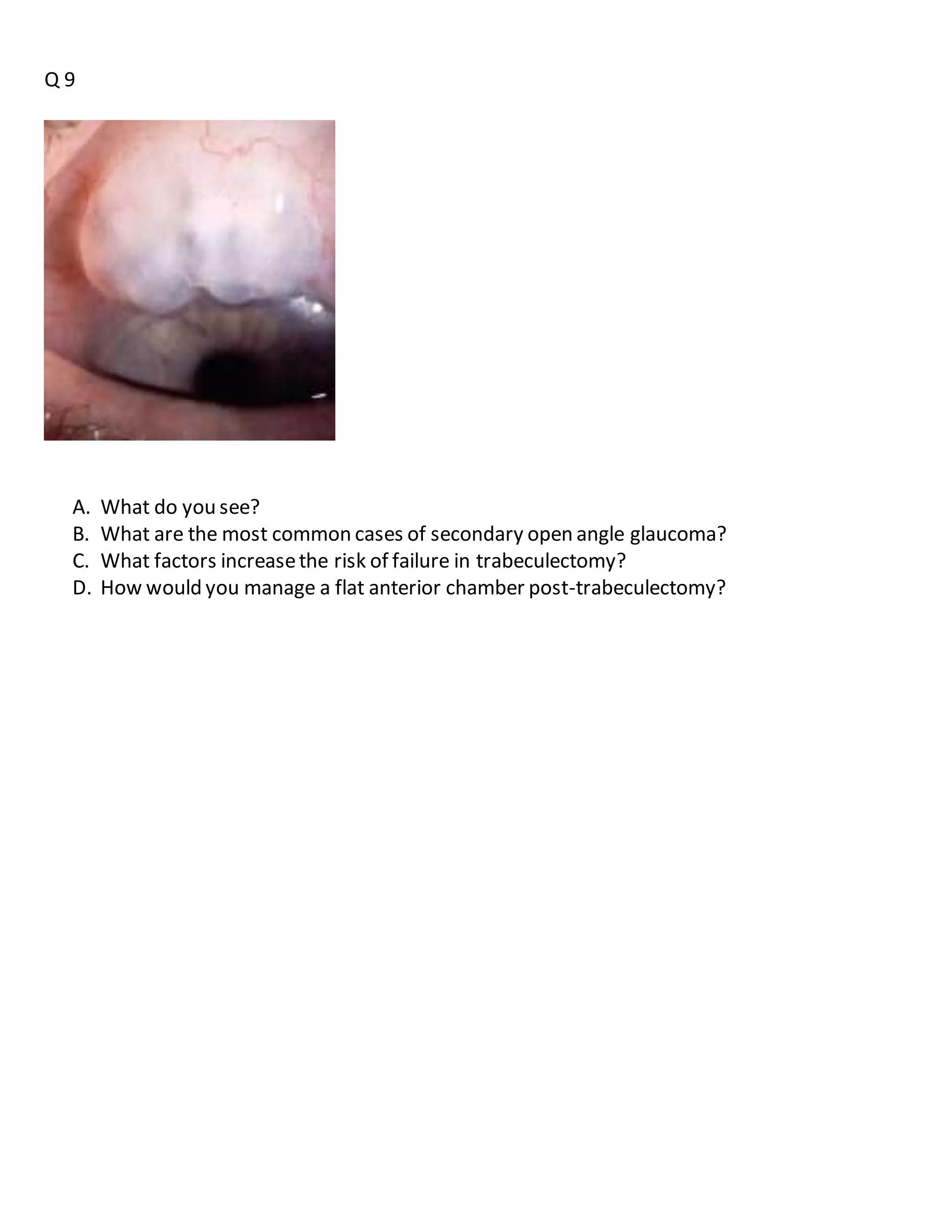 OSCE ophthalmology examination & answers | DOCX