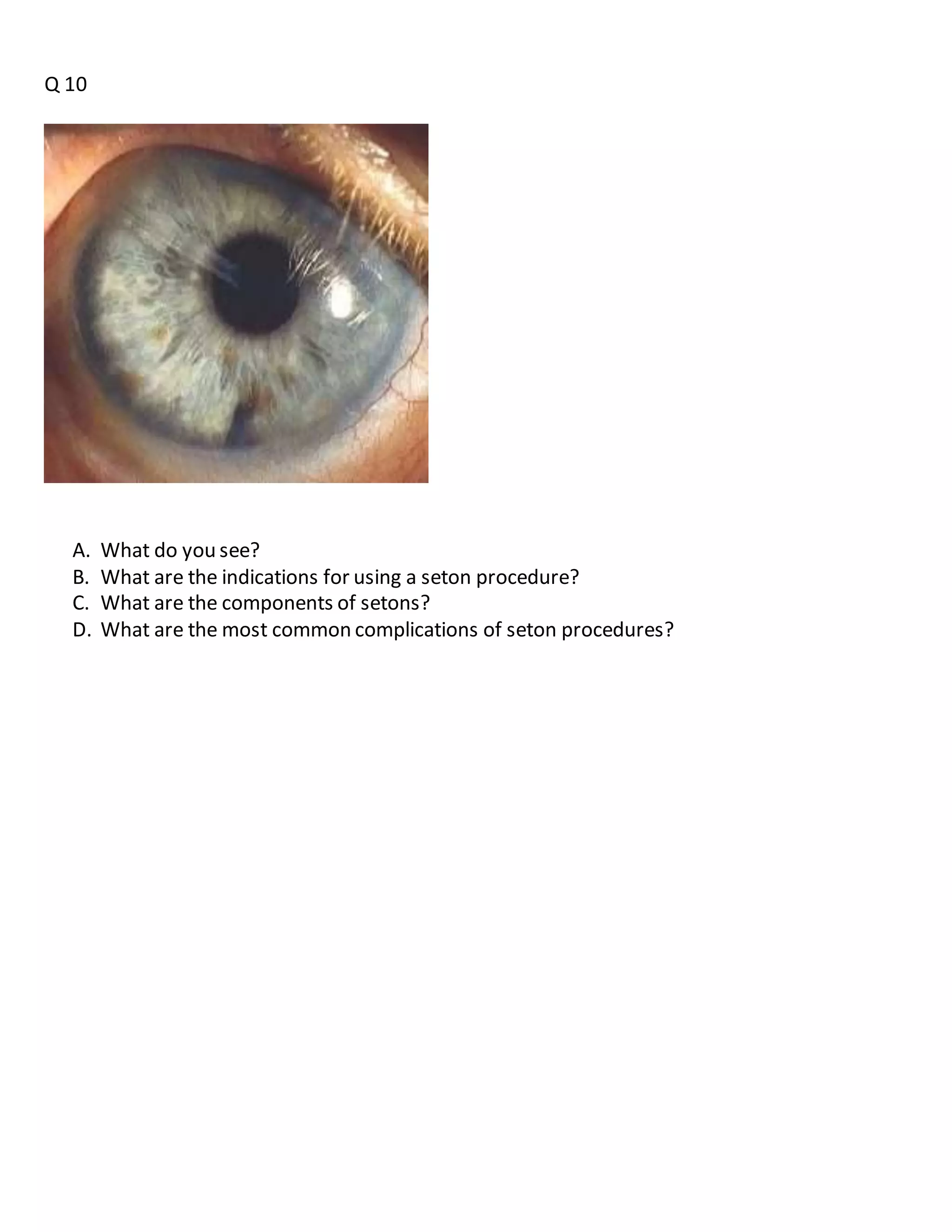 OSCE ophthalmology examination & answers | DOCX