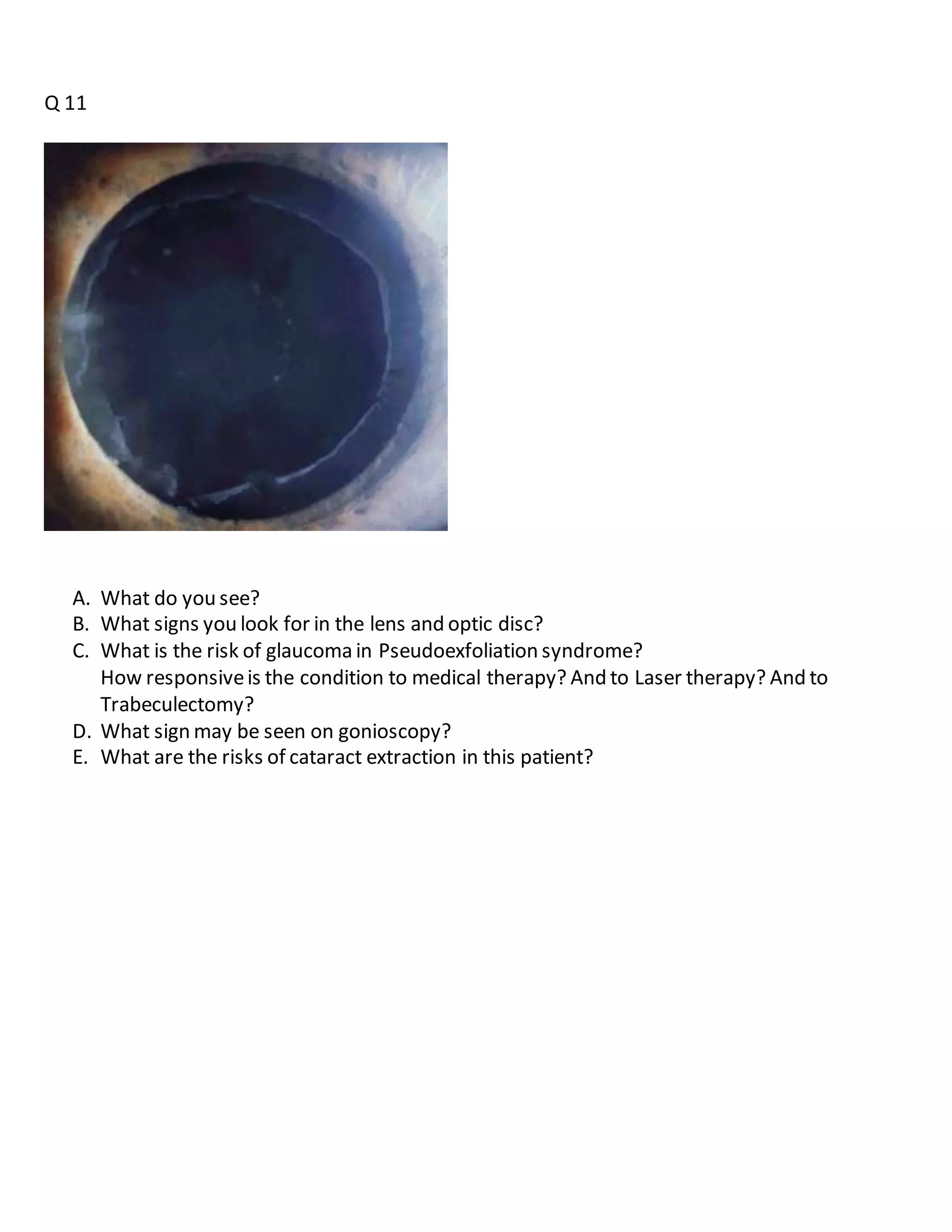 OSCE ophthalmology examination & answers | DOCX