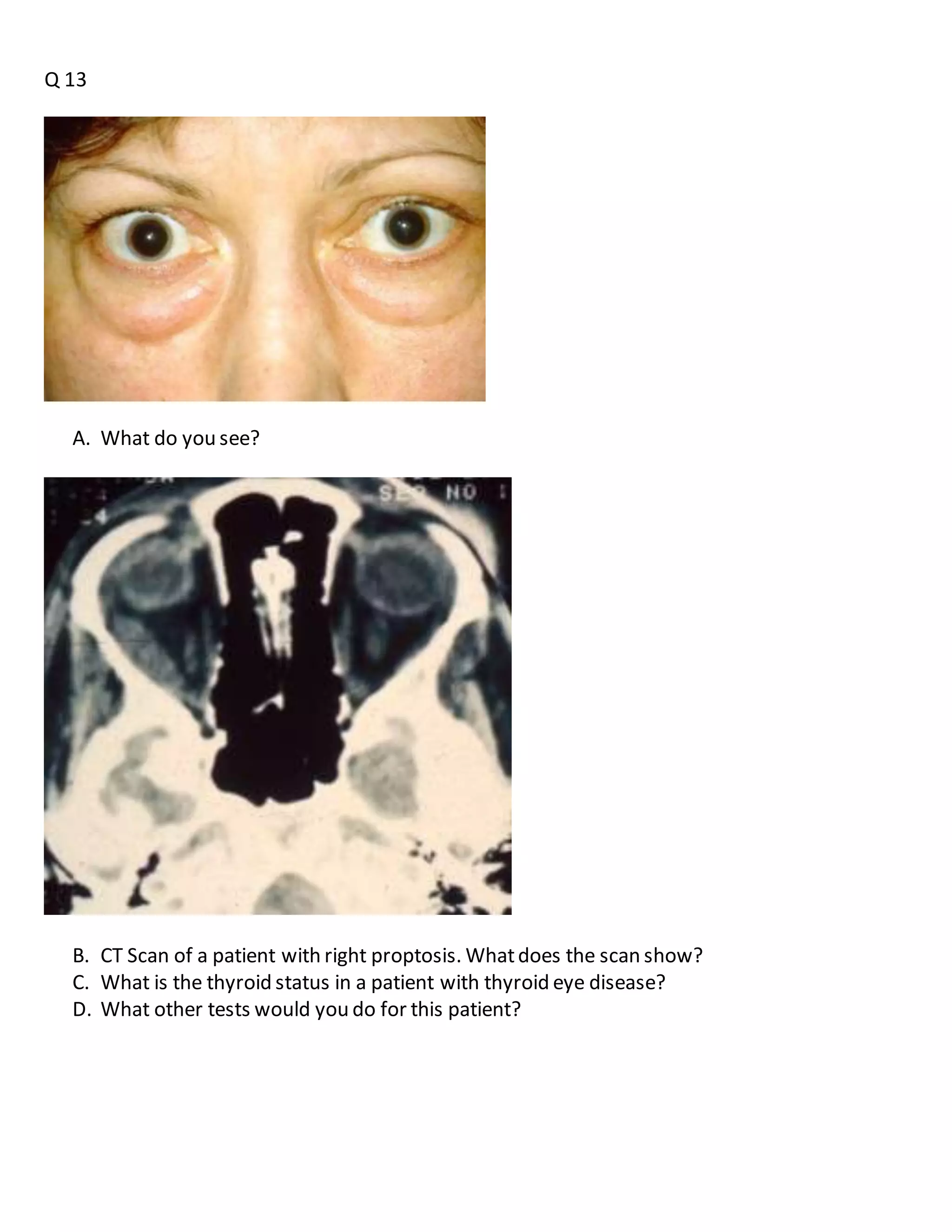 OSCE ophthalmology examination & answers | DOCX