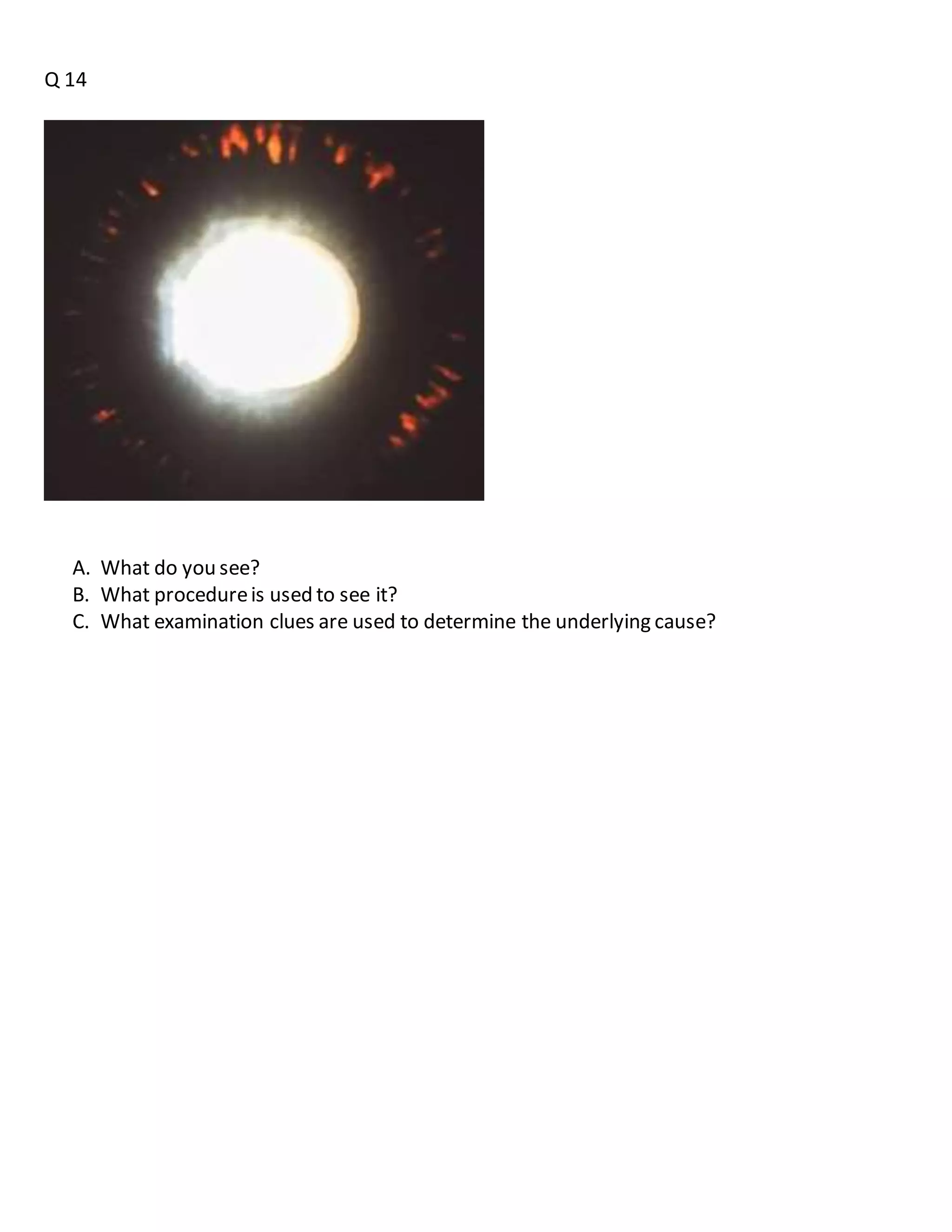 OSCE ophthalmology examination & answers | DOCX