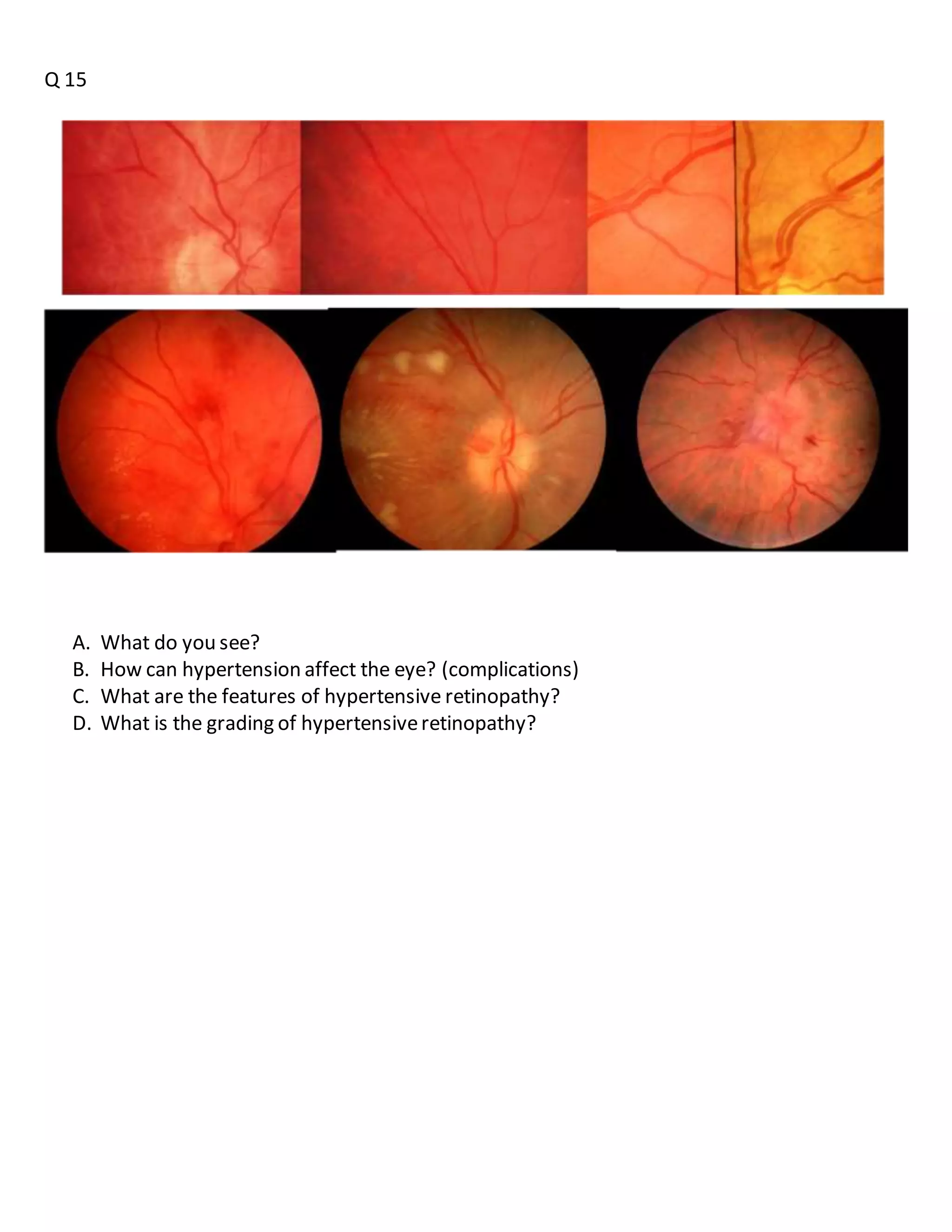 OSCE ophthalmology examination & answers | DOCX