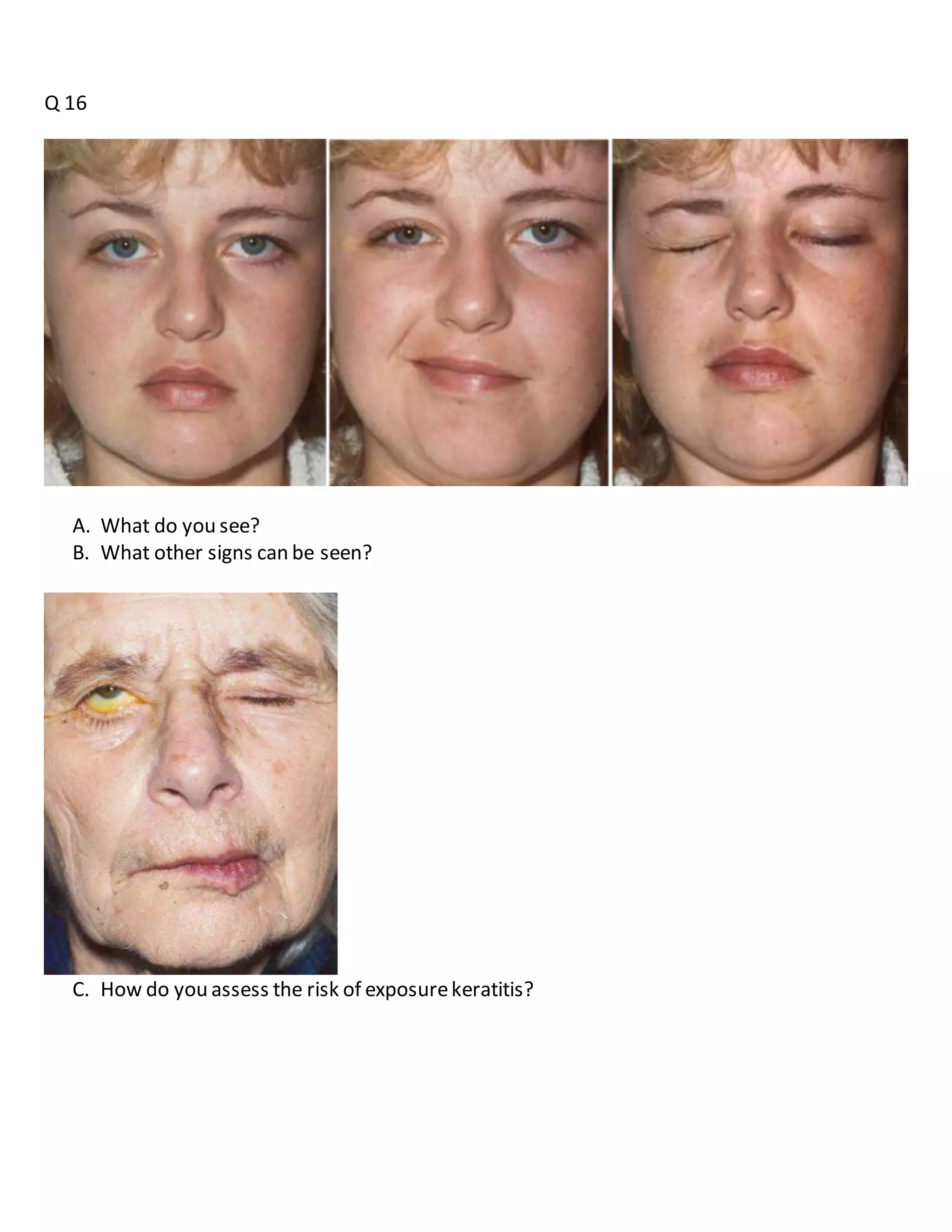 OSCE ophthalmology examination & answers | DOCX