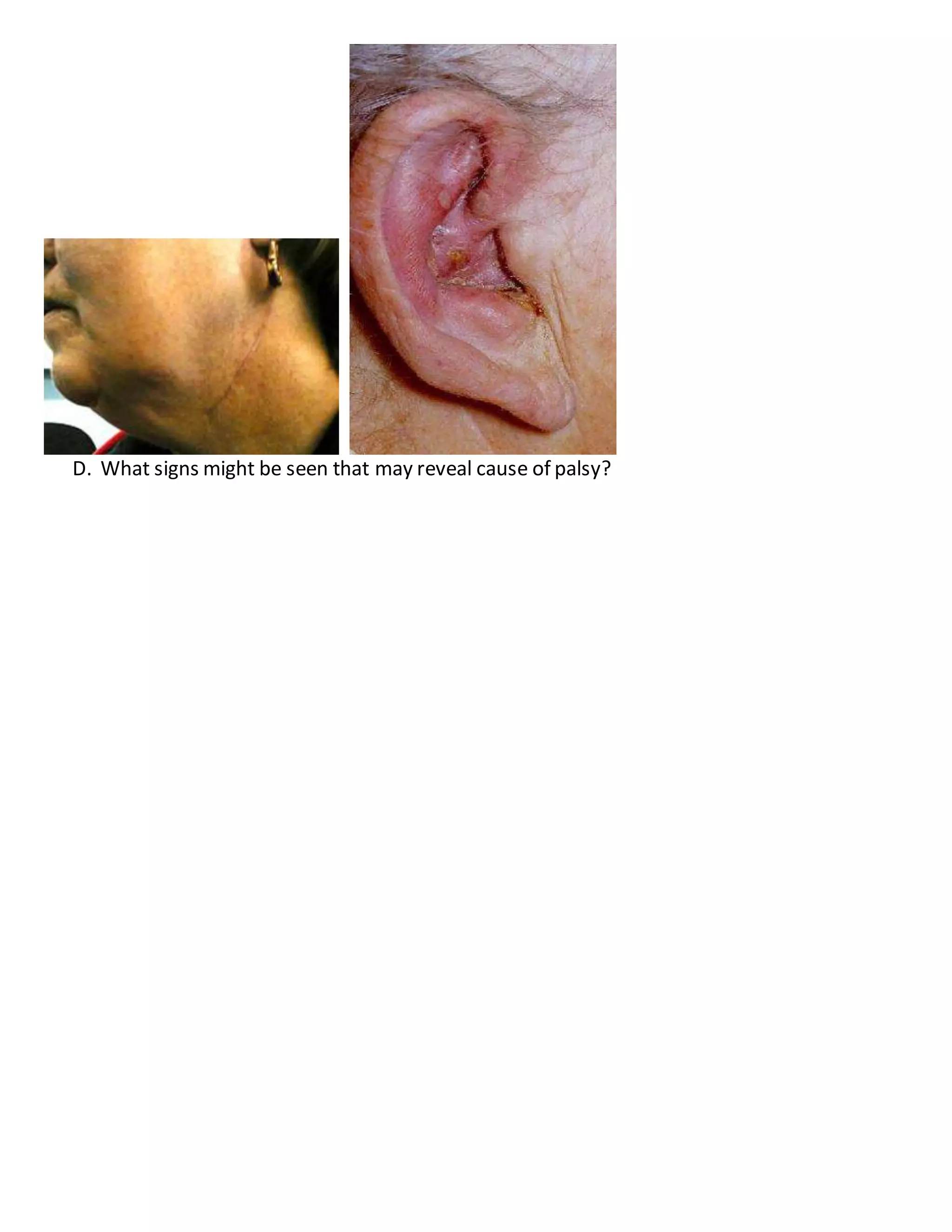 OSCE ophthalmology examination & answers | DOCX